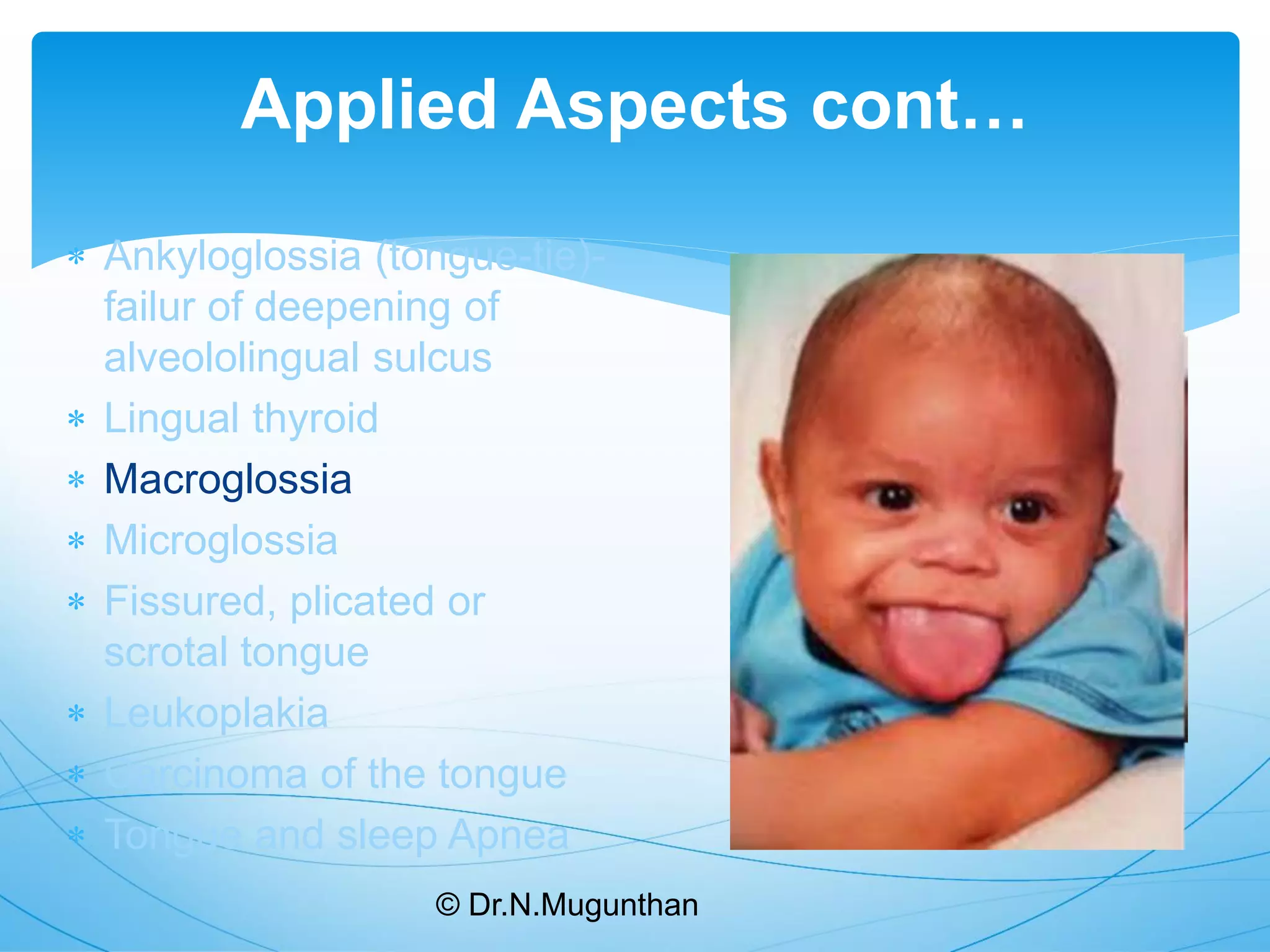 Tongue-Gross Anatomy & Applied Aspects. Dr.N.Mugunthan.M.S | PDF