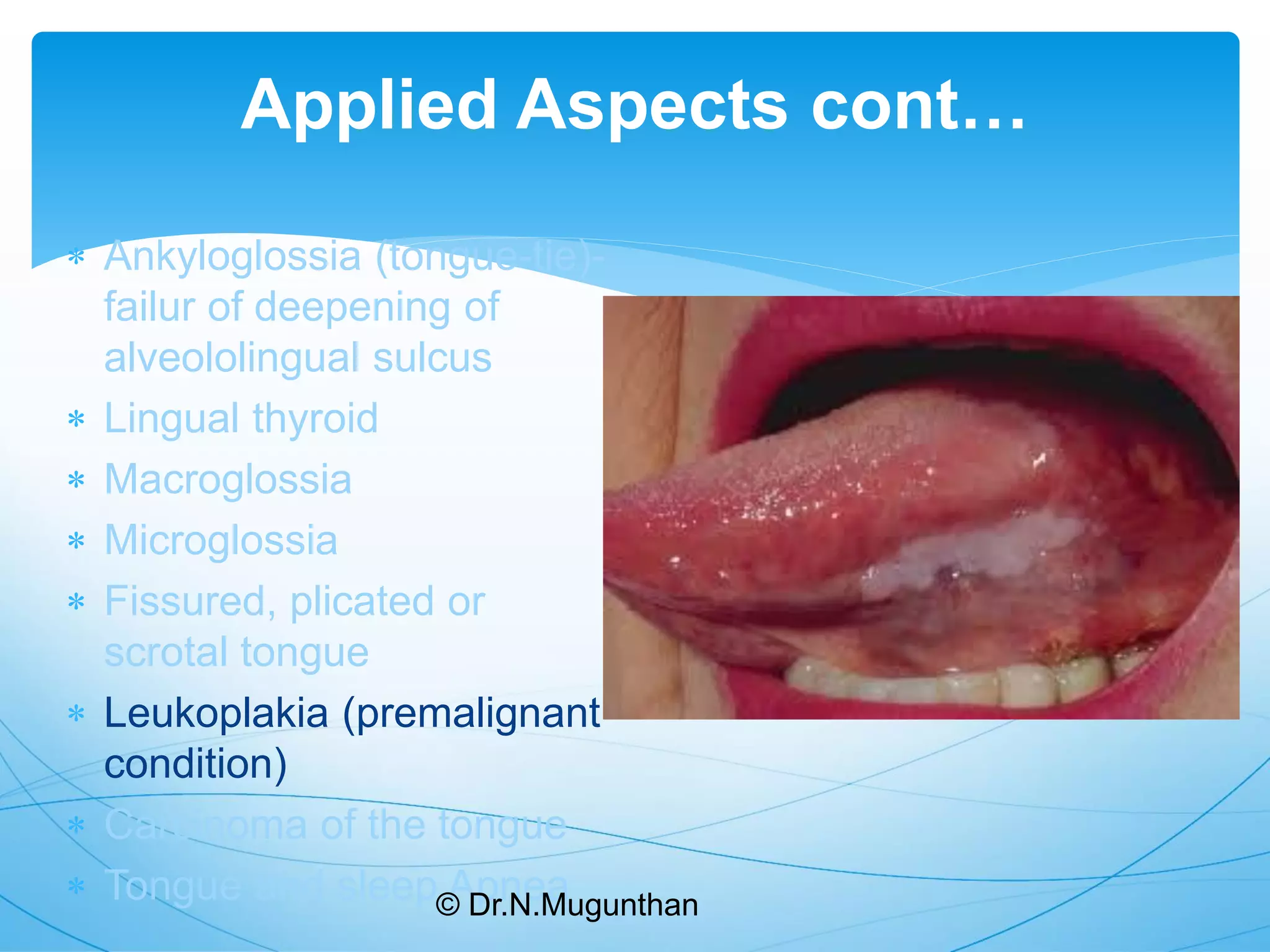 Tongue-Gross Anatomy & Applied Aspects. Dr.N.Mugunthan.M.S | PDF