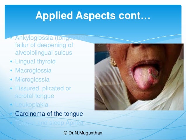 Tongue-Gross Anatomy & Applied Aspects. Dr.N.Mugunthan.M.S