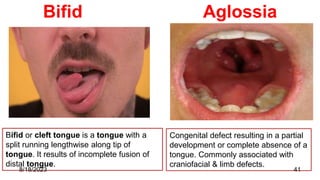 tongue and hypoglossal nerve.ppt