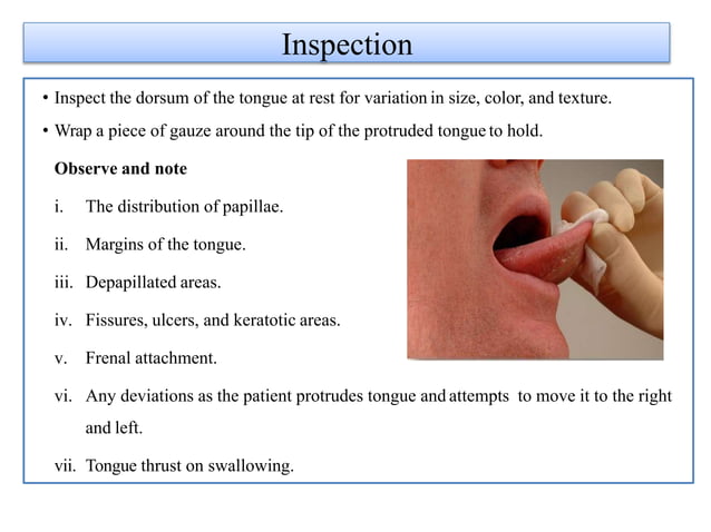 Tongue and its applied aspects | PPTX
