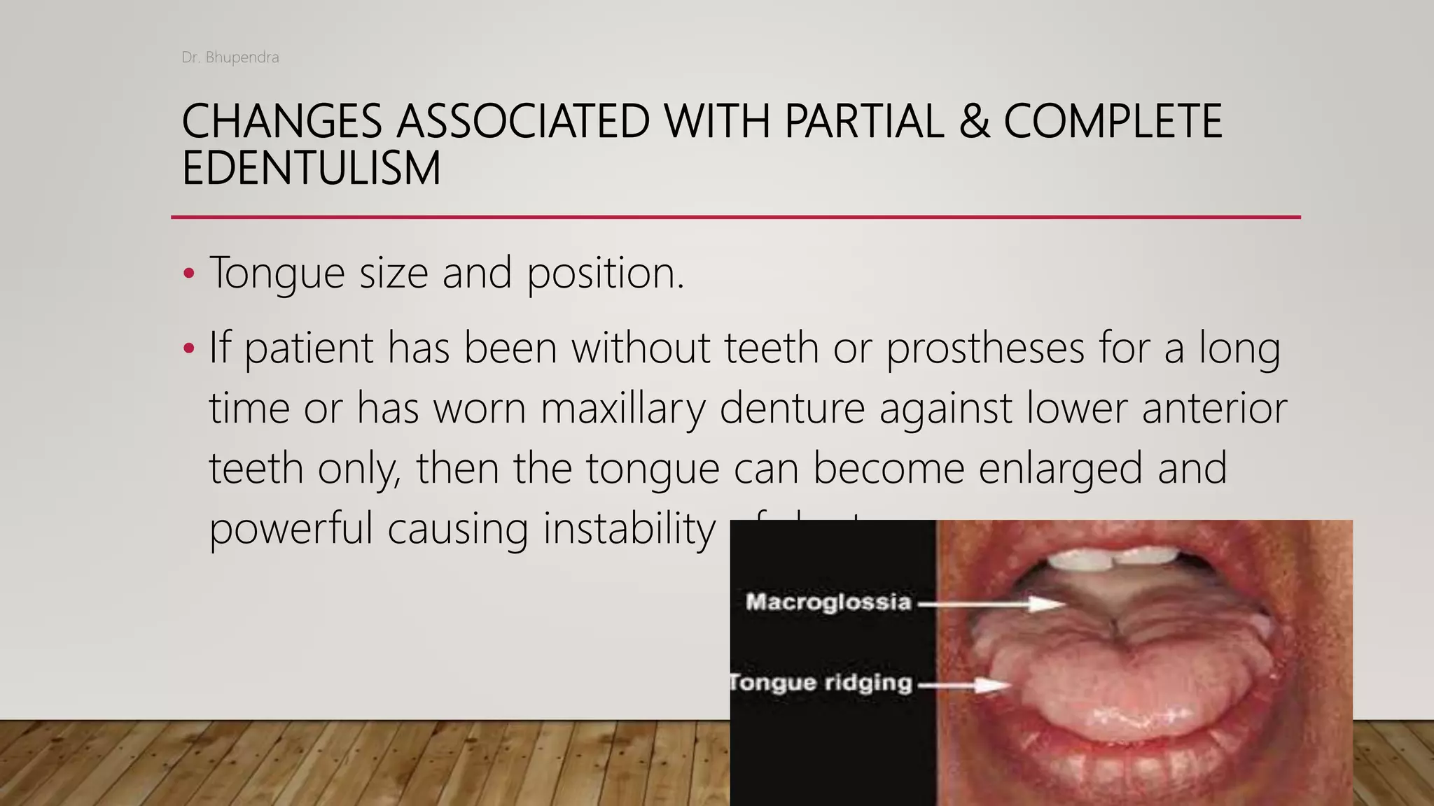 Tongue and its prosthodontic considerations | PPTX