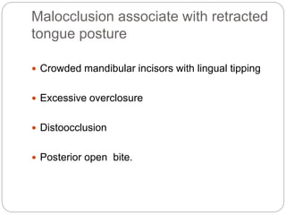 Tongue and malocclusion - by DR. GAURAV VARMA . MDS | PPTX