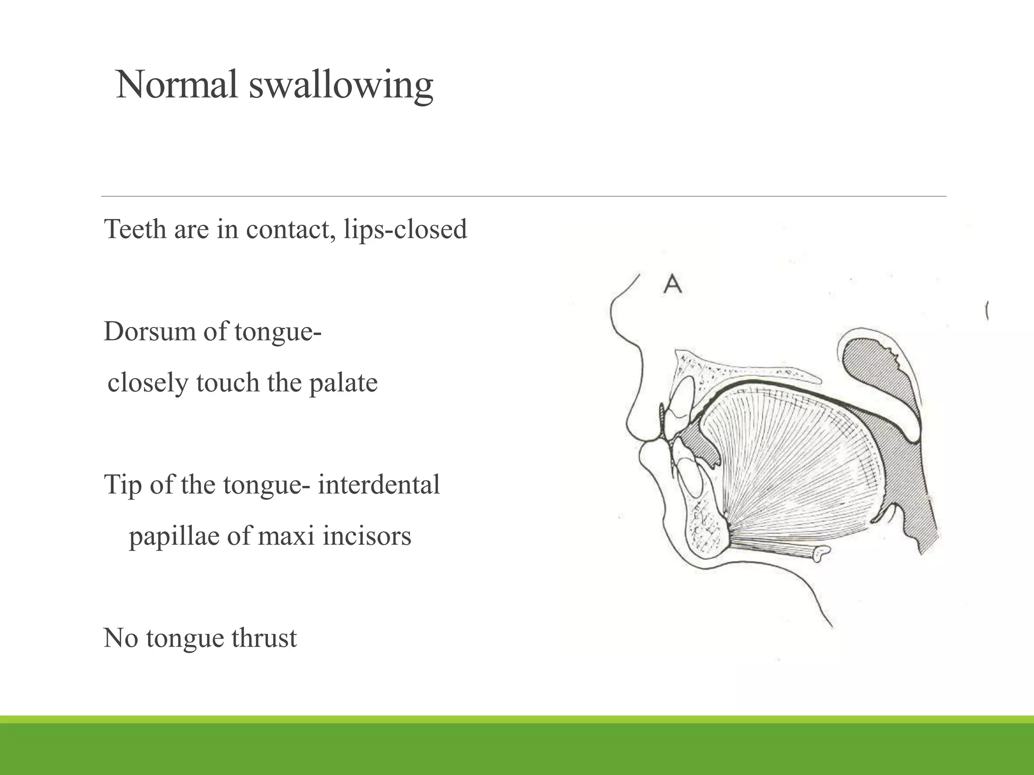 tongue and malocclusion - Copy.pptx