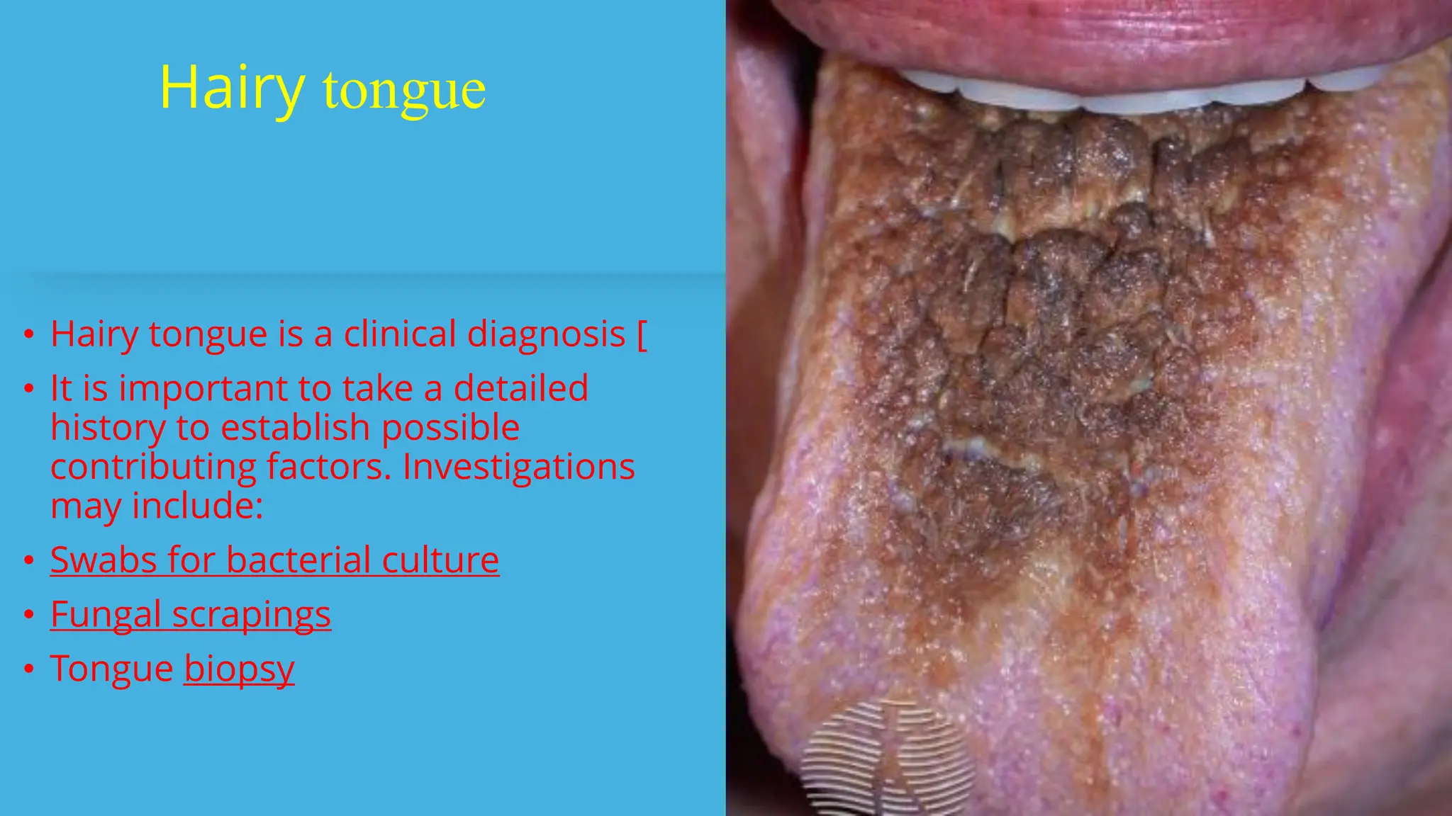 tongue disease lecture Dr Assadawy legacy | PDF
