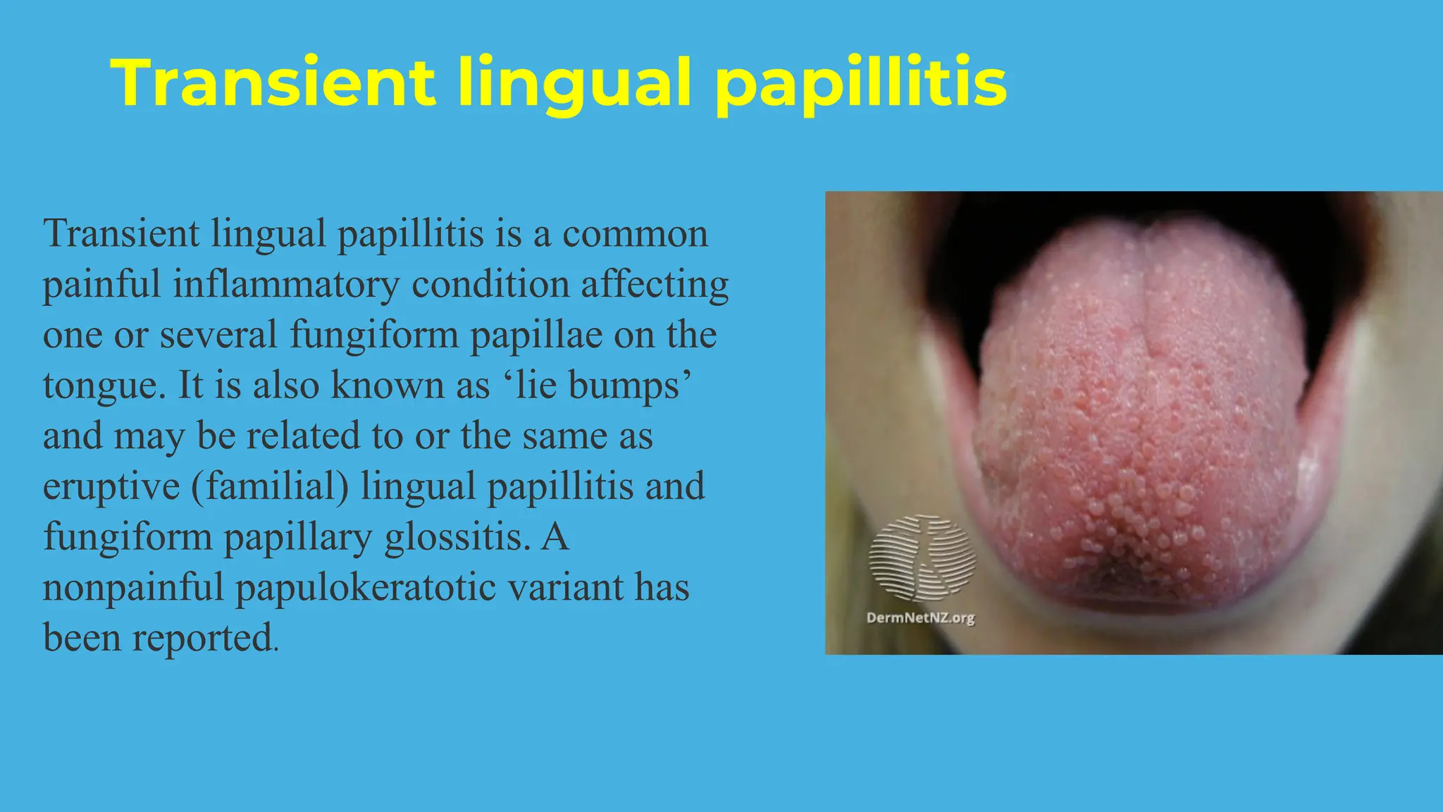 tongue disease lecture Dr Assadawy legacy | PDF