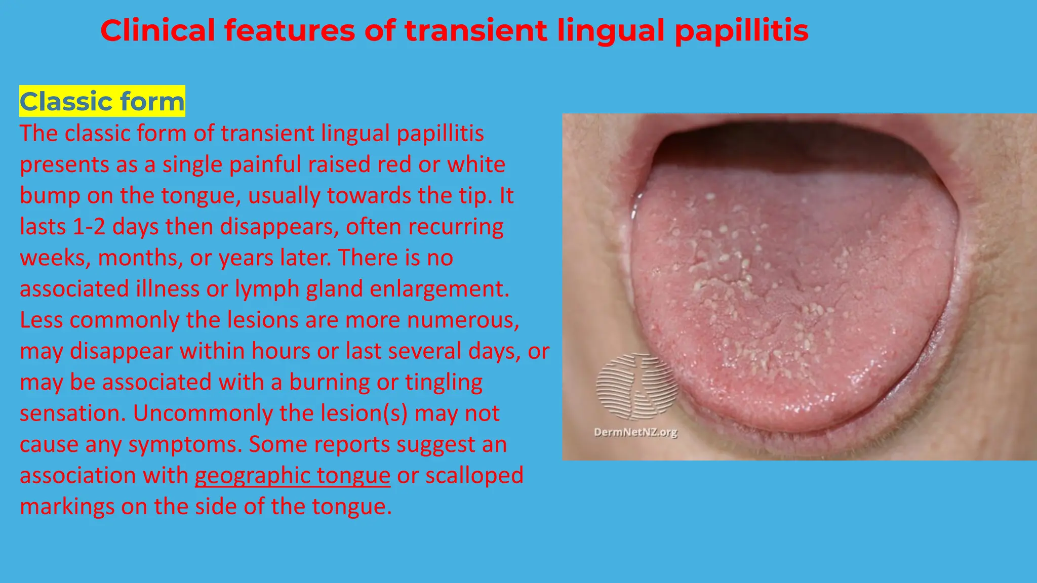 tongue disease lecture Dr Assadawy legacy | PDF