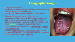 tongue disease lecture Dr Assadawy legacy | PDF