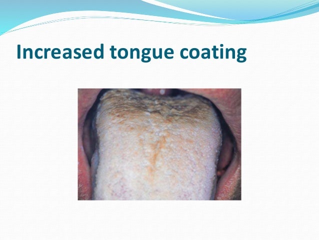Tongue diseases