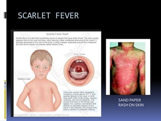 Tongue disorders | PPTX