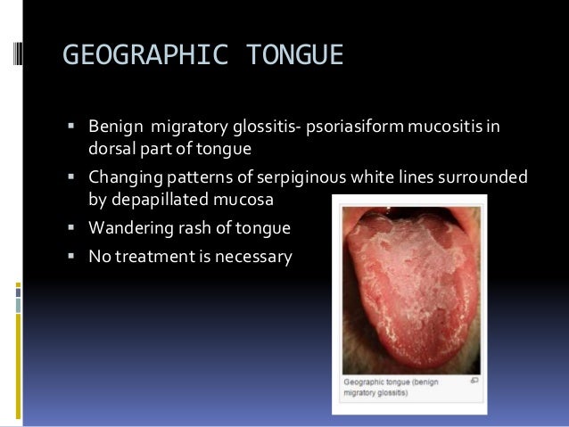 Tongue disorders