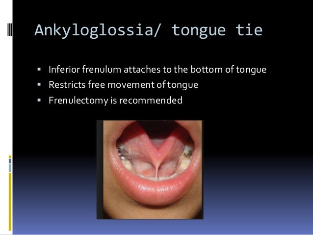 Tongue disorders