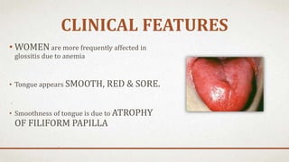 Tongue disorders | PPTX