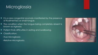TONGUE DISORDERS in oral medicine... .pptx