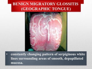 Tongue disorders | PPT