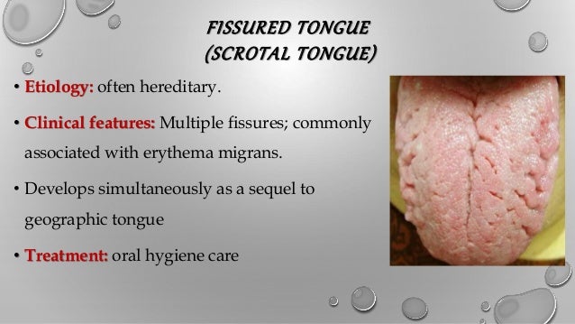 development & growth of tongue