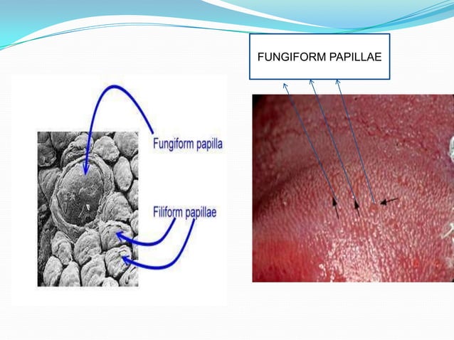 Anatomy of Tongue | PPTX | Thyroid Disorders | Endocrine and Metabolic ...