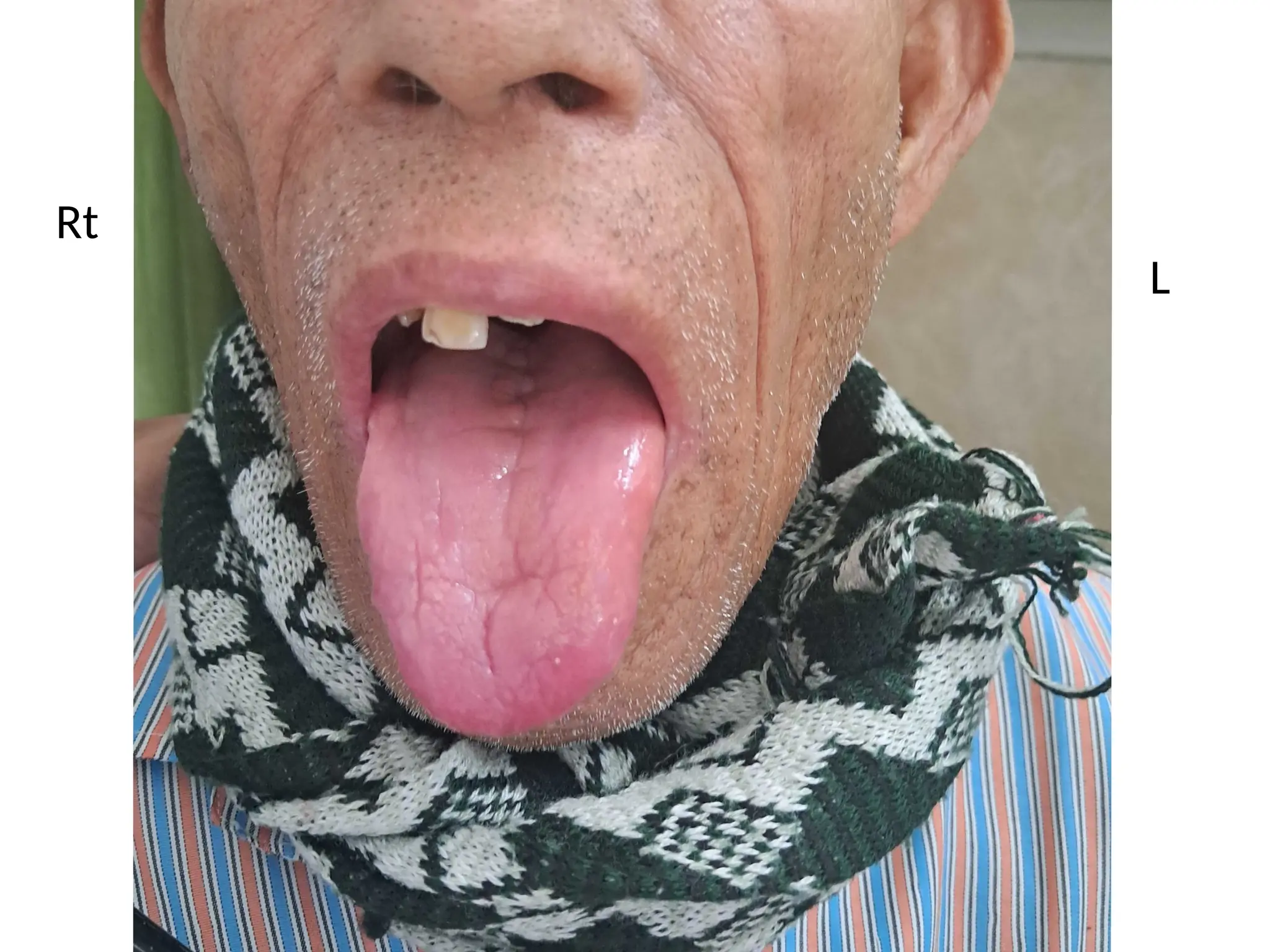 Tongue Office how to do dx of tounge.pptx