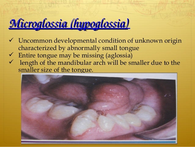 Tongue ppt