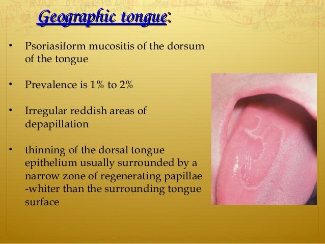 Tongue ppt