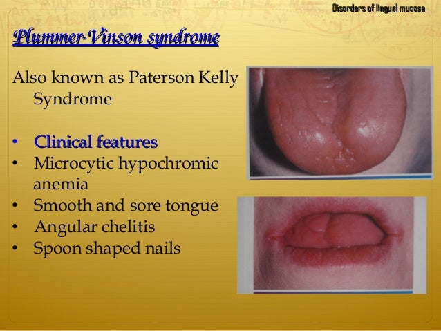 Tongue ppt