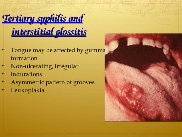 Tongue ppt