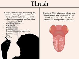 The Tongue | PPTX
