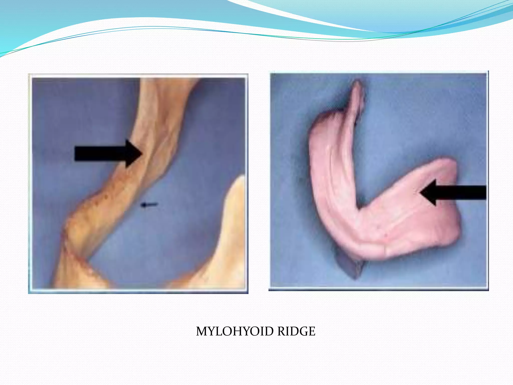 Tongue & its prosthetic coniderations seminar | PPTX
