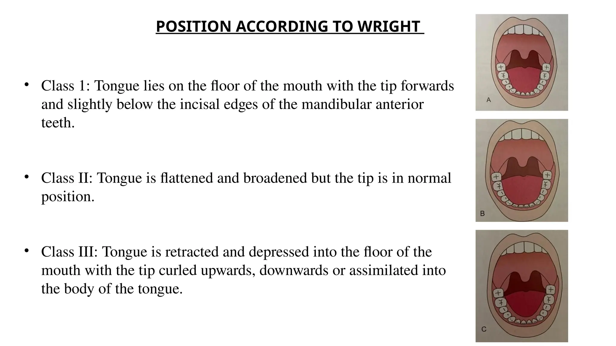 Tongue and Its Implications in Prosthodontics .pptx