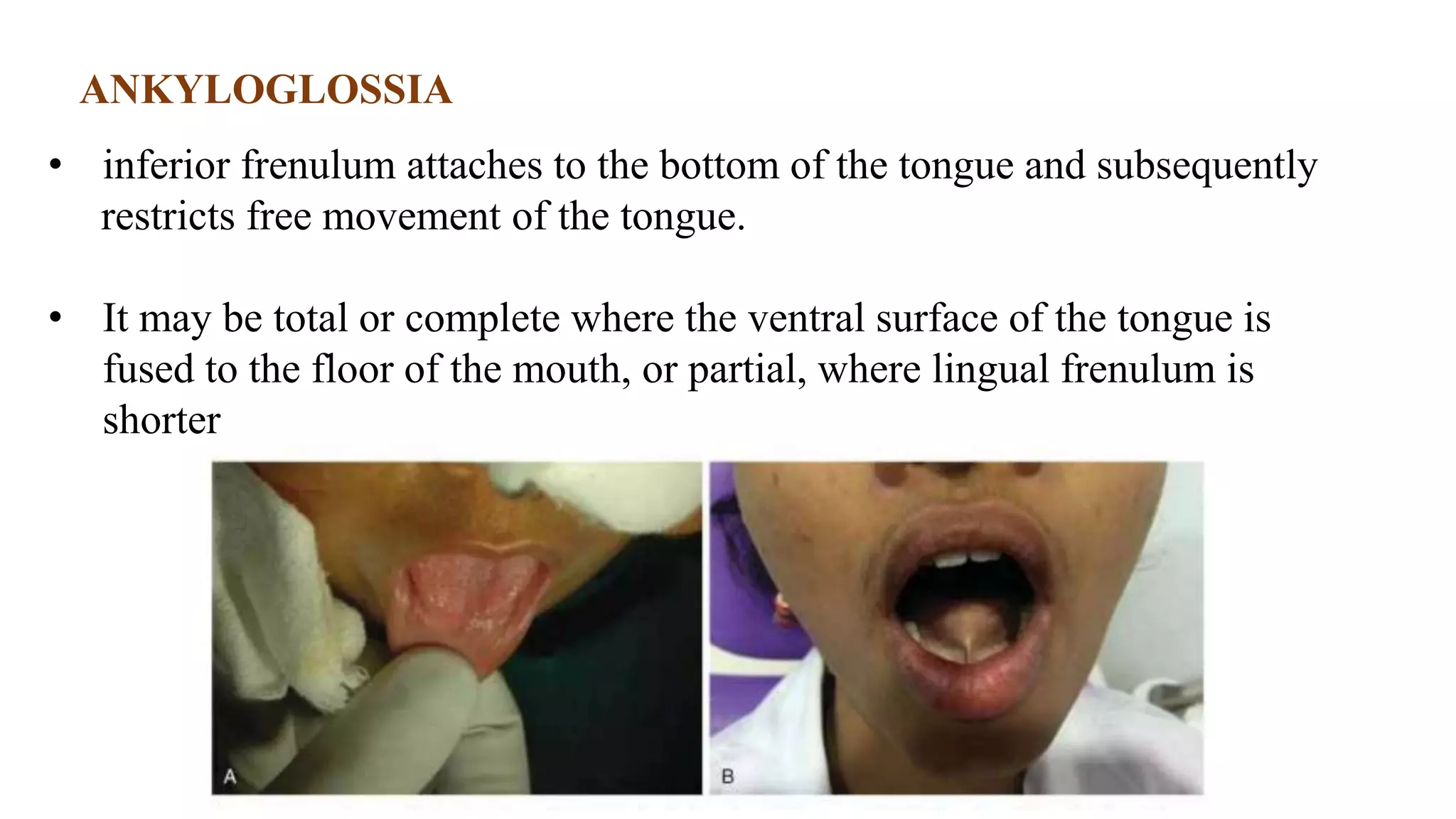 Anatomy of Tongue | PPTX