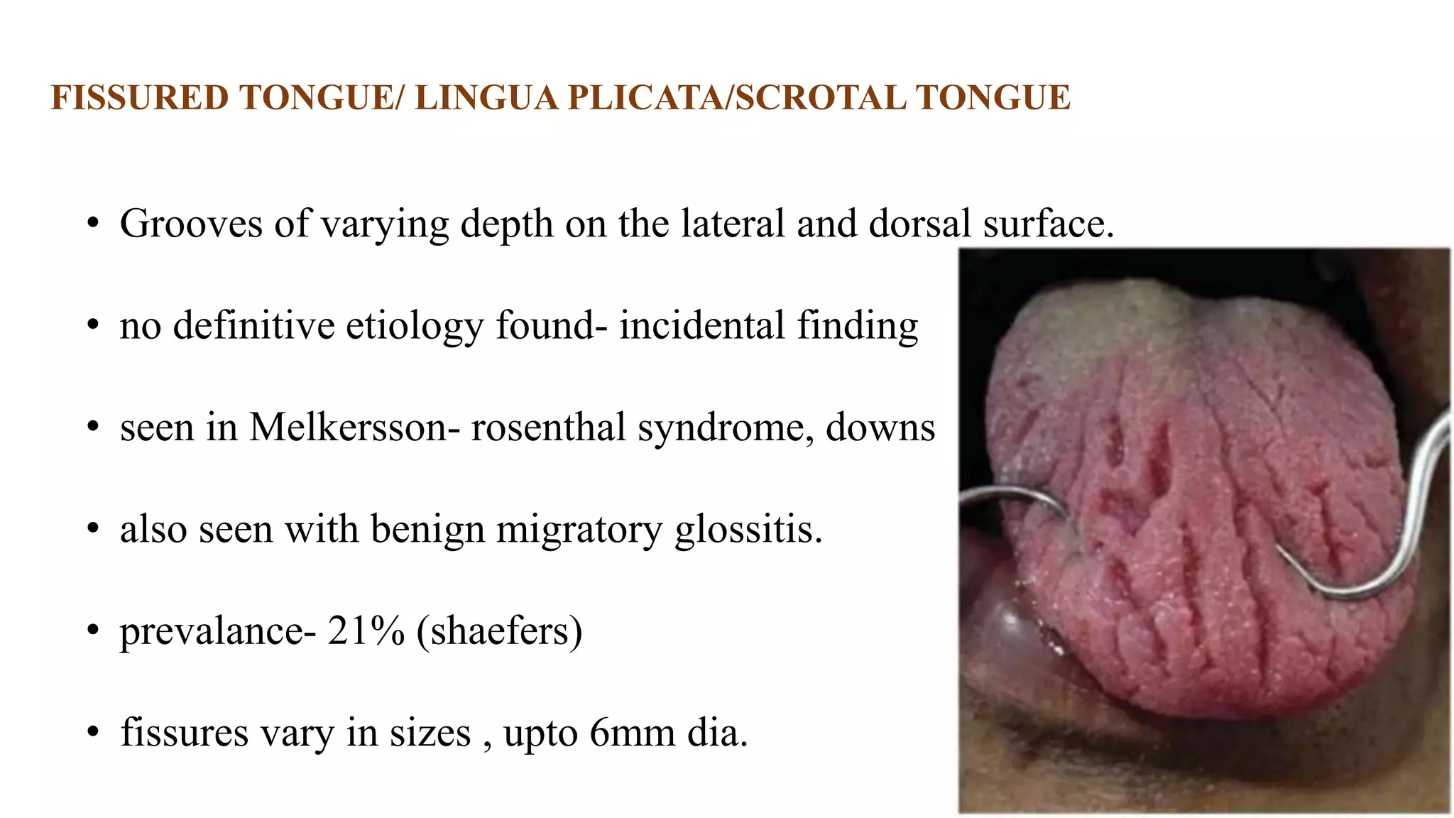 Anatomy of Tongue | PPTX