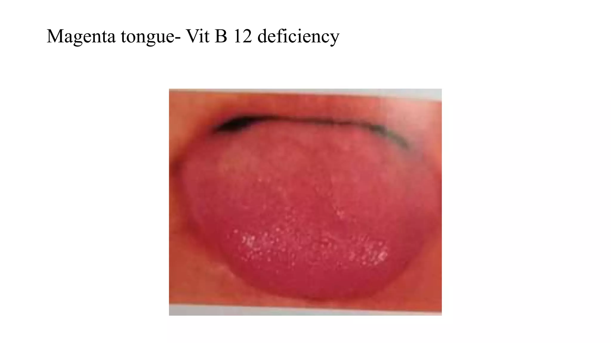 Anatomy of Tongue | PPTX | Ear, Nose and Throat Conditions | Diseases ...