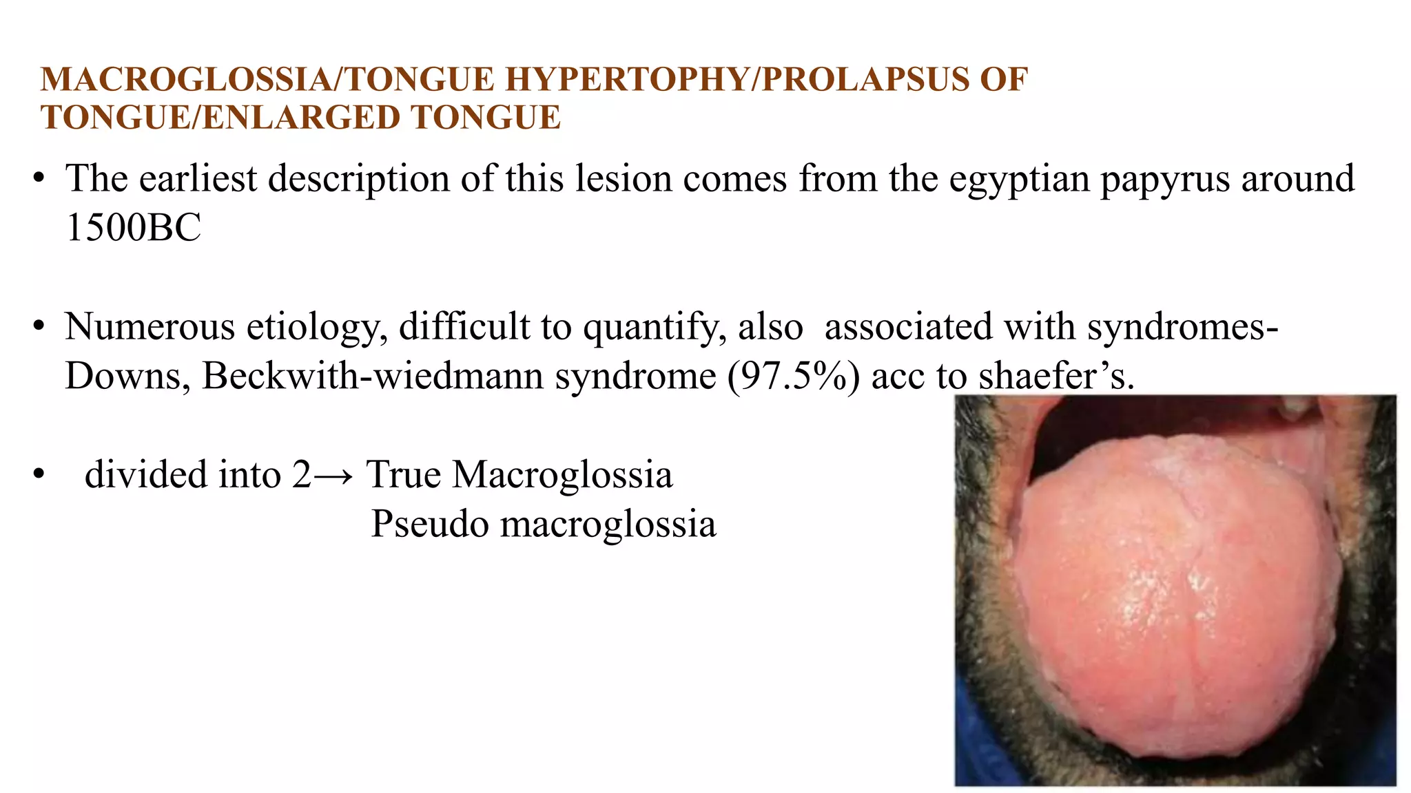 Anatomy of Tongue | PPTX