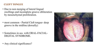 Anatomy of Tongue | PPTX