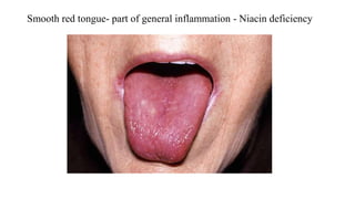 Anatomy of Tongue | PPTX