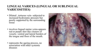 Anatomy of Tongue | PPT