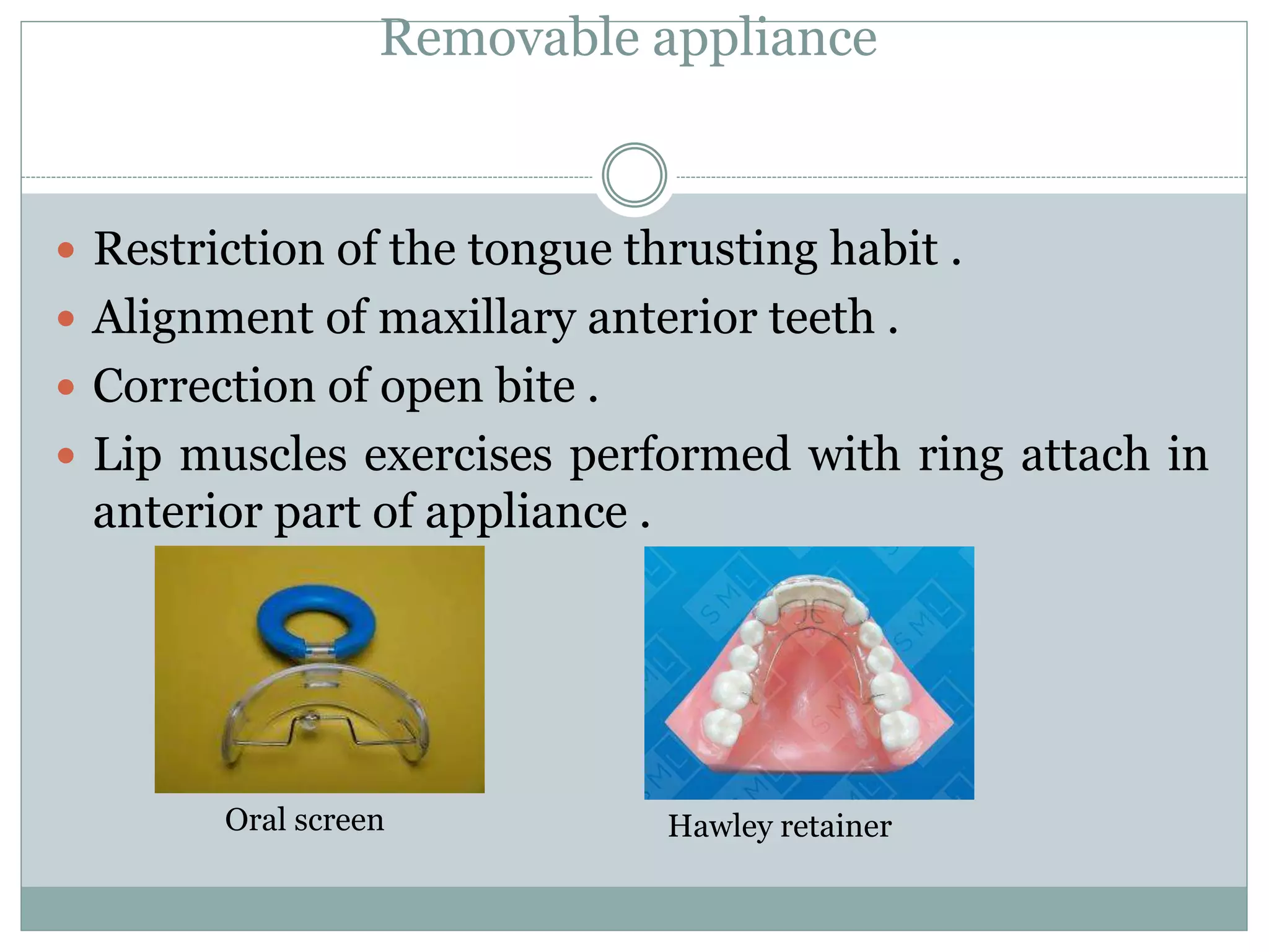 Tongue thrust | PPTX