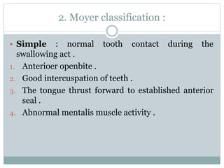 Tongue thrust | PPTX