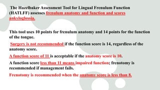 Tongue tieDiagnosis and mangement .pptx