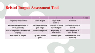 Tongue tieDiagnosis and mangement .pptx