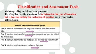 Tongue tieDiagnosis and mangement .pptx