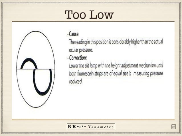 Tonometer - Basics & Types | PDF | Eye and Vision Conditions | Diseases ...