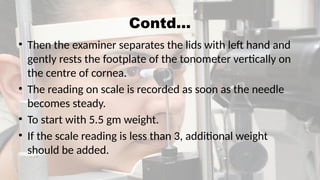 INTRA OCULAR PRESSURE BY TONOMETER .pptx