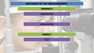 INTRA OCULAR PRESSURE BY TONOMETER .pptx