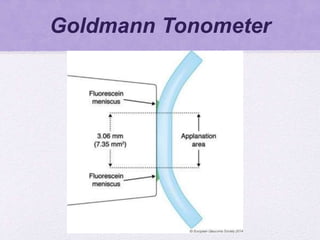Tonometer final.pptx