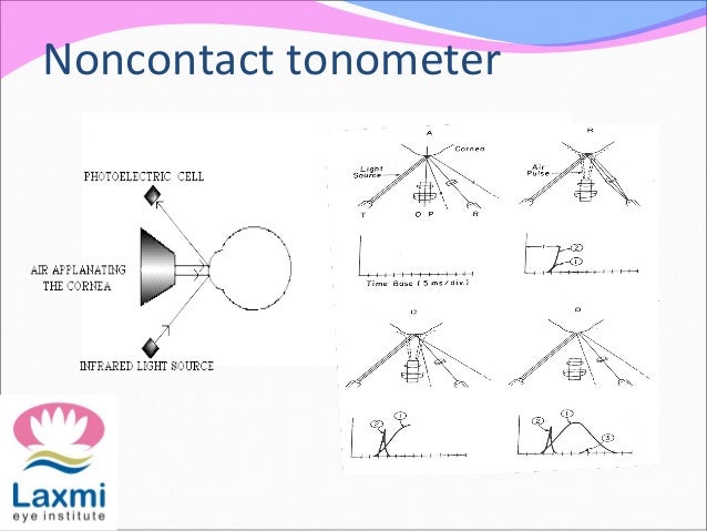 Tonometry