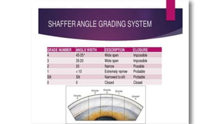 Tonometry (Ophthalmology) | PPTX | Eye and Vision Conditions | Diseases ...