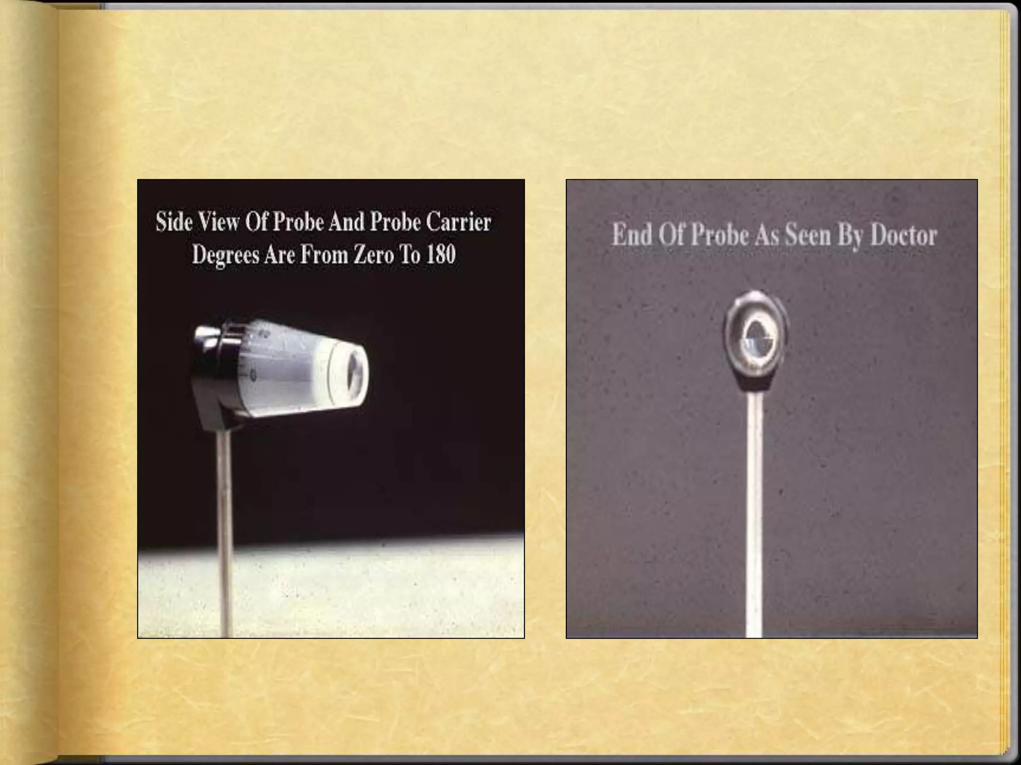 Different types of Tonometry | PPTX