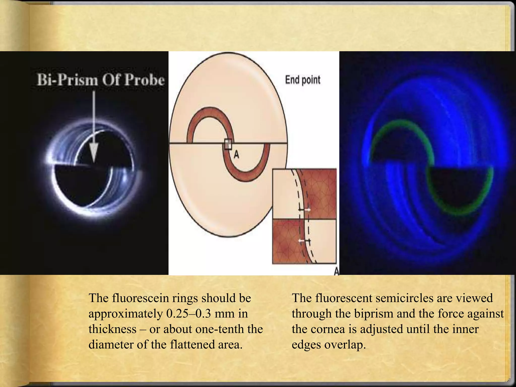 Different types of Tonometry | PPTX