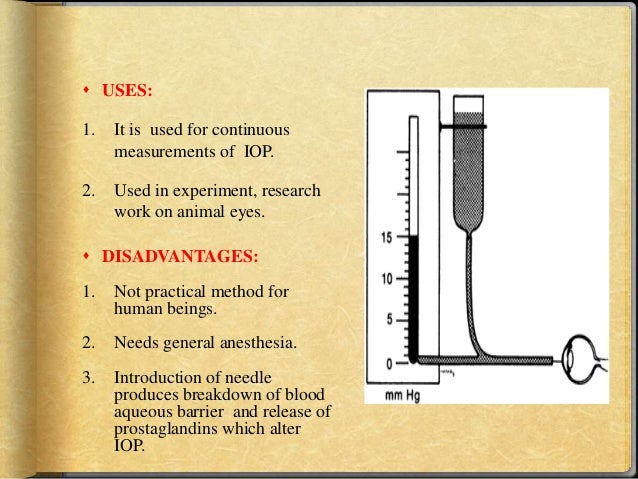 Different types of Tonometry